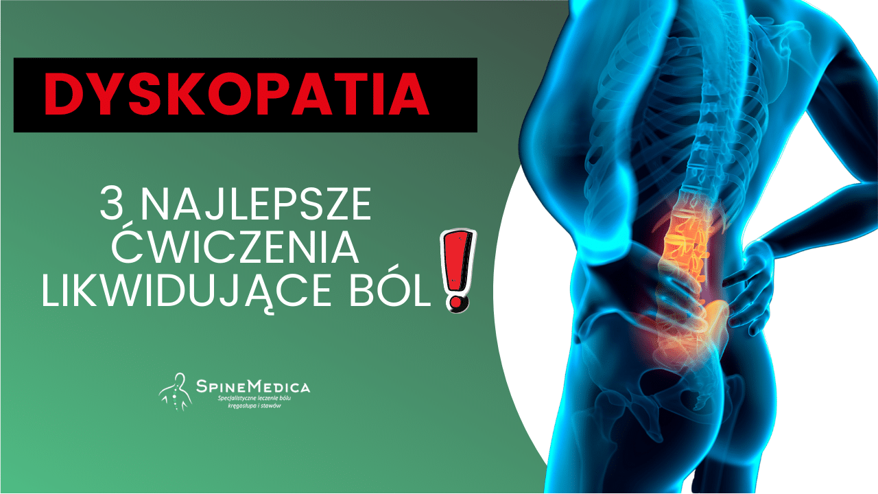 Dyskopatia ćwiczenia – 3 sposoby na ból kręgosłupa - Spine Medica